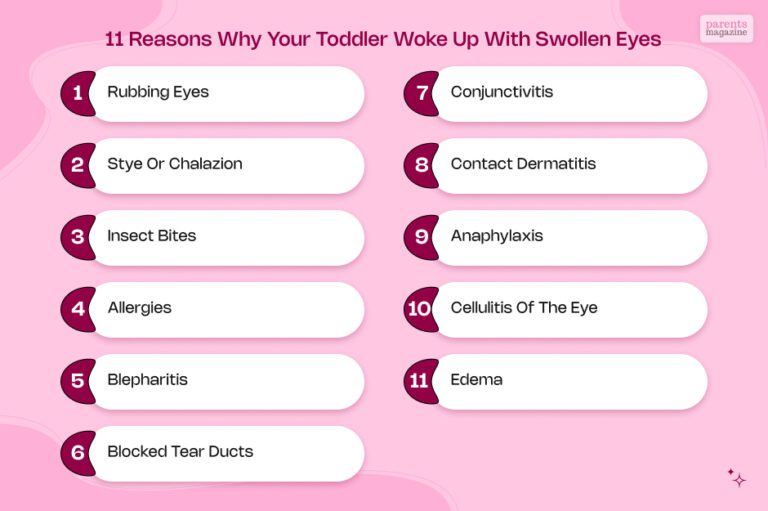 My Toddler Woke up With Swollen Eyes: Reasons That Can Cause