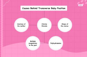 Having a Transverse Baby? Here Is What You Should Know