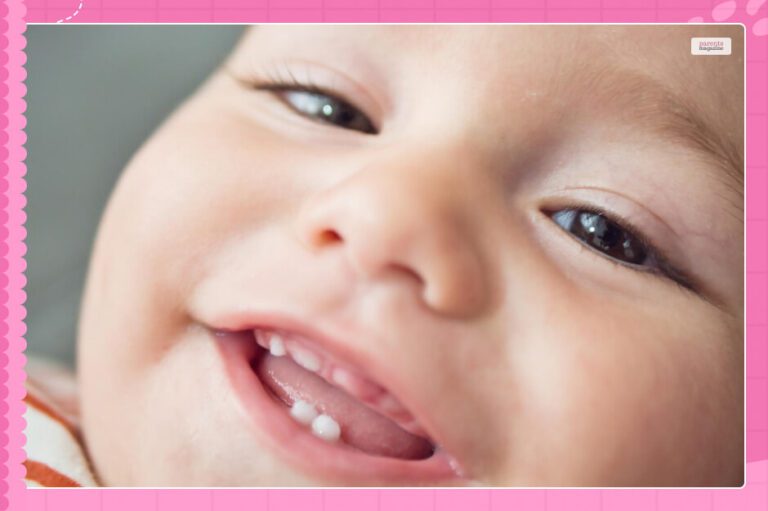 Eruption Cyst Baby: Should You Be Worried?